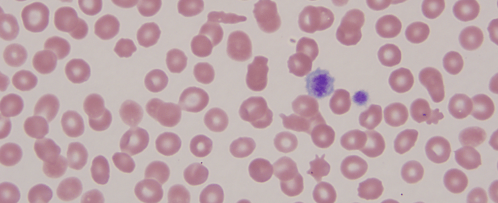 Polikromazi nedir? - Genel Kültür